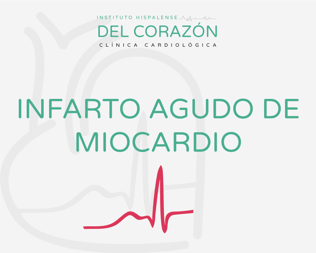 Infarto Agudo de Miocardio – Instituto Hispalense del Corazón
